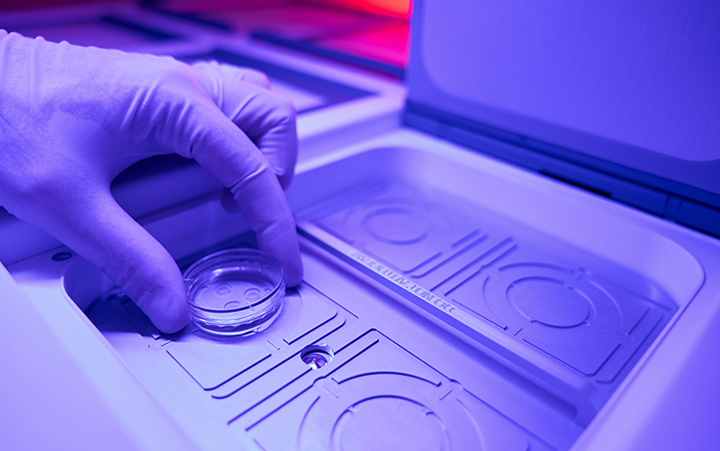 Embryo Freezing (Cryopreservation) & Frozen Embryo Transfer (FET ...